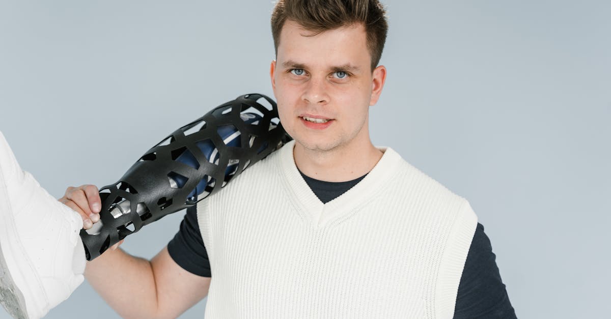 3D Printed Prosthetics: Revolutionizing Lives with Custom Comfort and ...